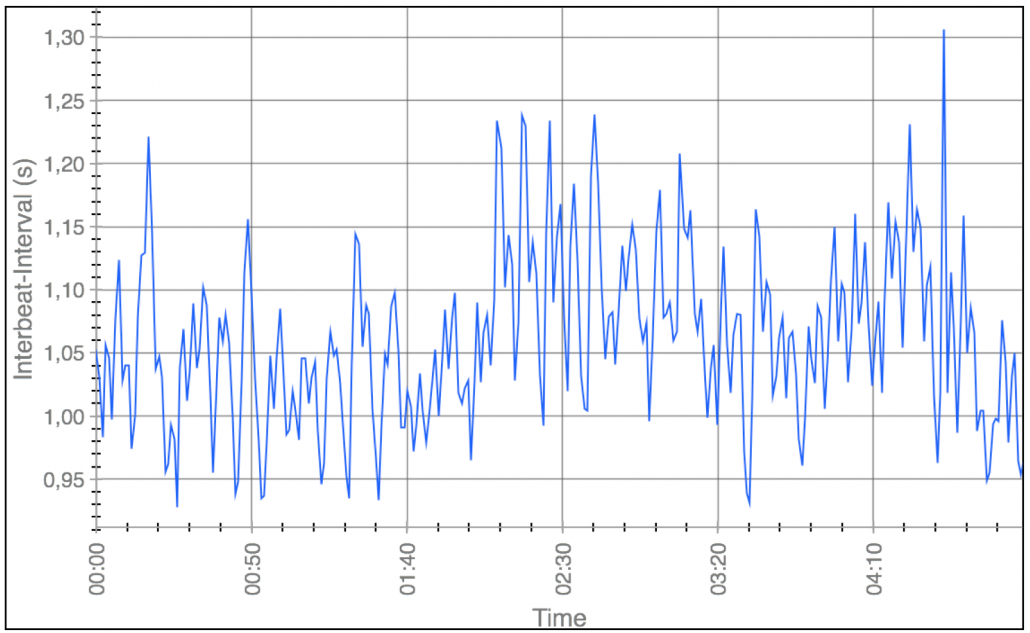 HRV Measurement and Parameter - aquaquinta.com